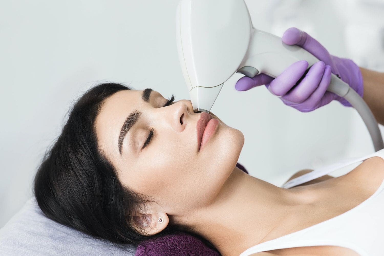 Photo Rejuvenation Treatment - Medical Spa in Hamilton, NJ